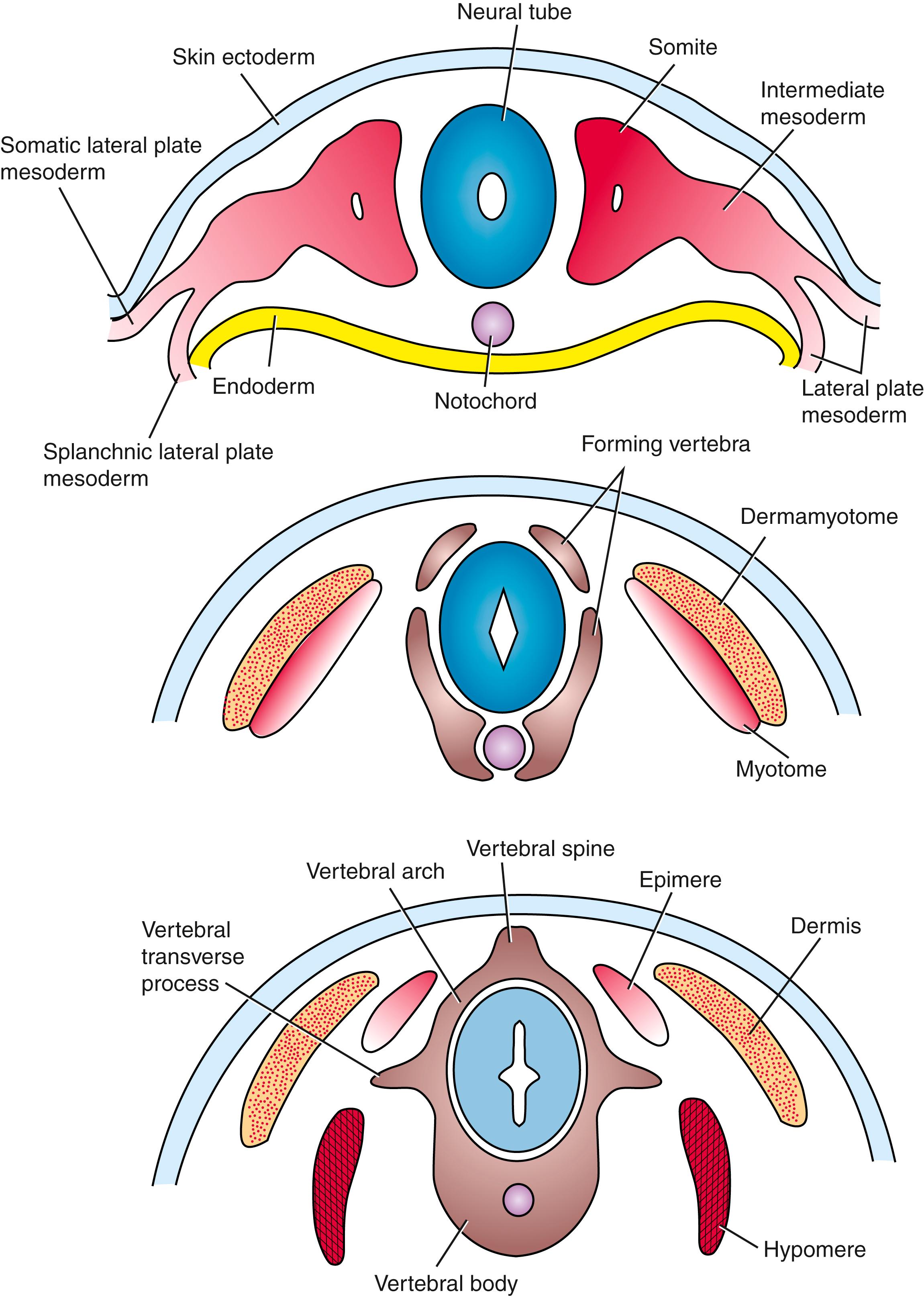 Development of the Musculoskeletal System - Clinical Tree