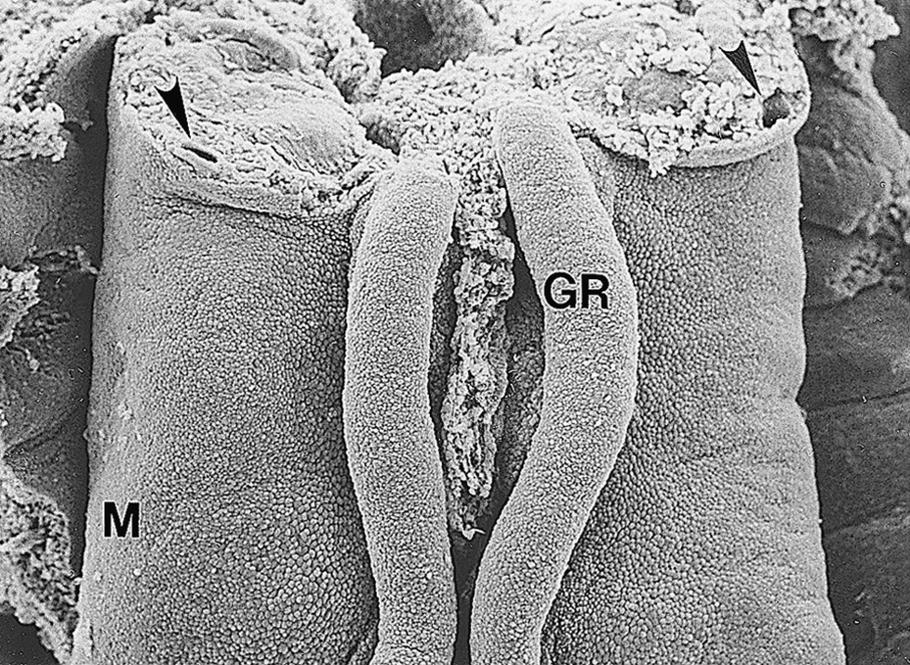Development of the Reproductive System - Clinical Tree