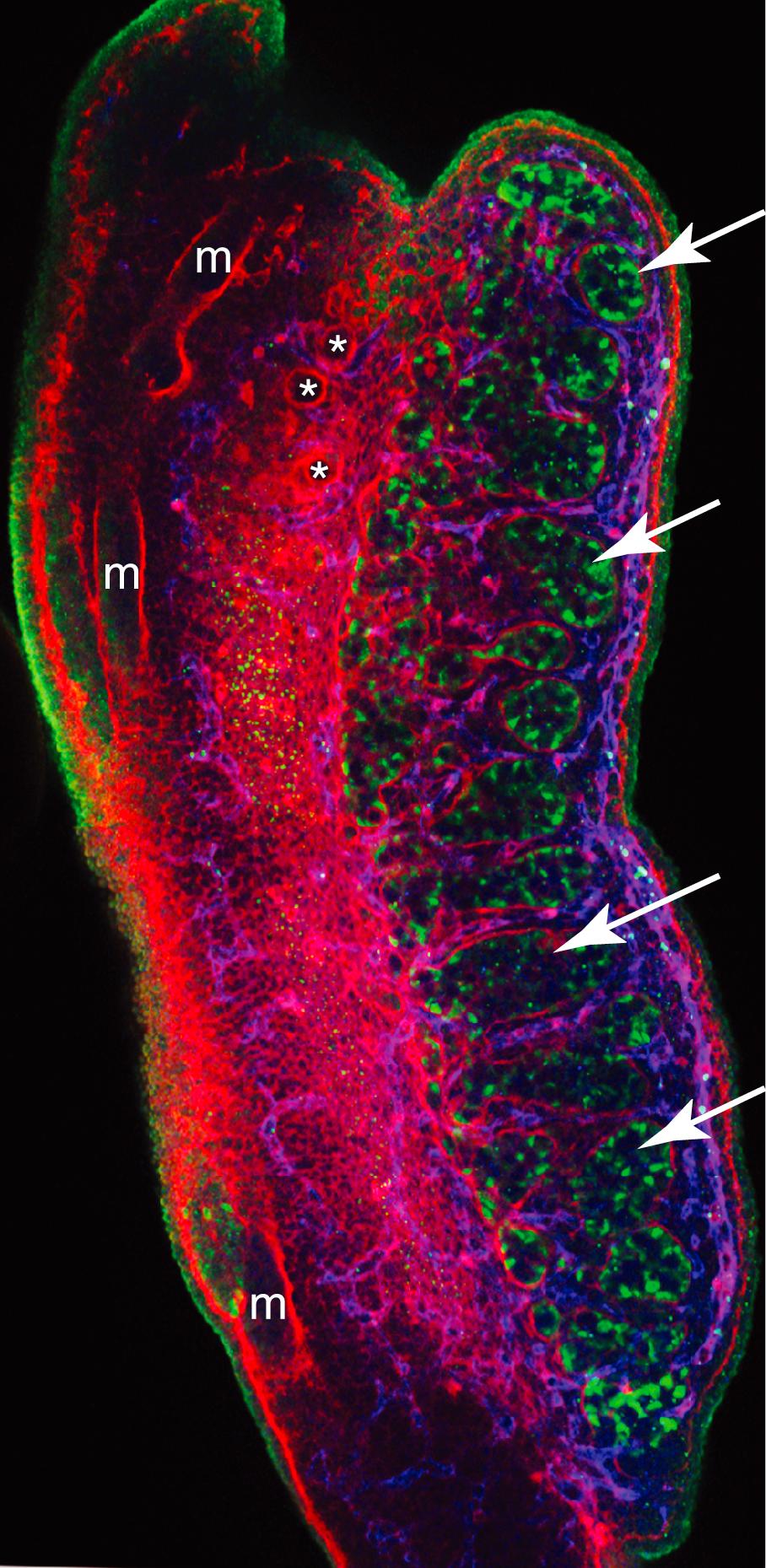 Development of the Reproductive System - Clinical Tree