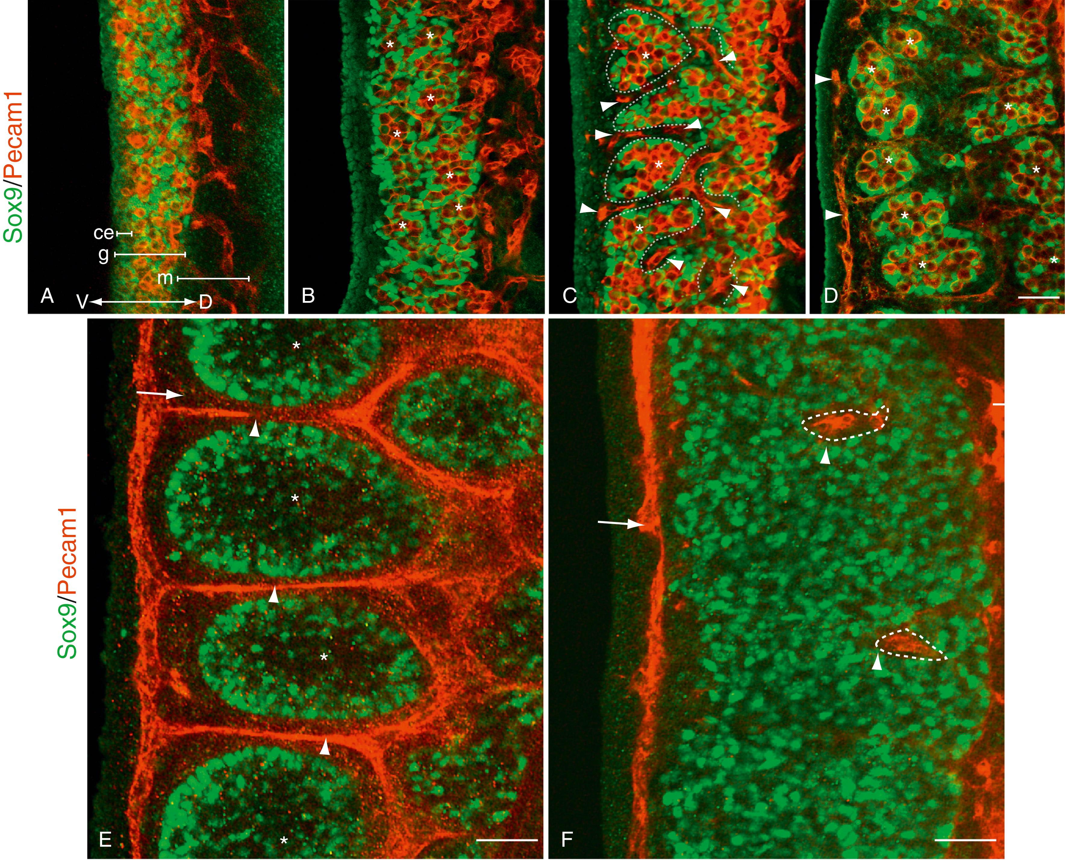 Development of the Reproductive System - Clinical Tree
