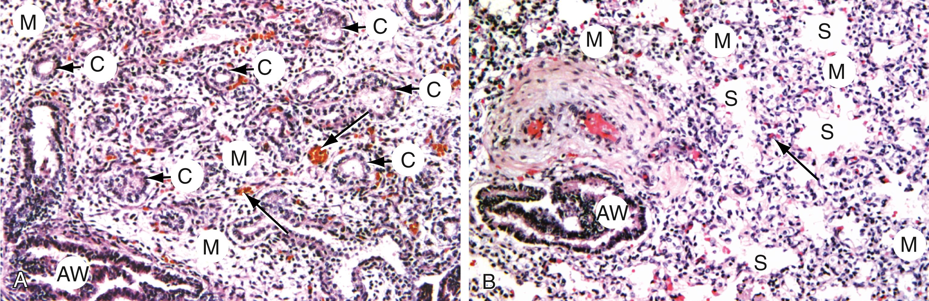 Development of the Respiratory System and Body Cavities - Clinical Tree