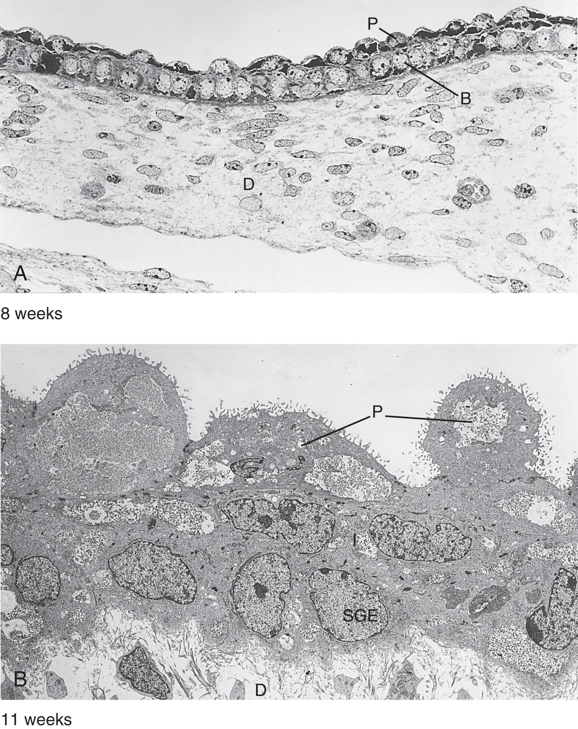 Development of the Skin and Its Derivatives - Clinical Tree