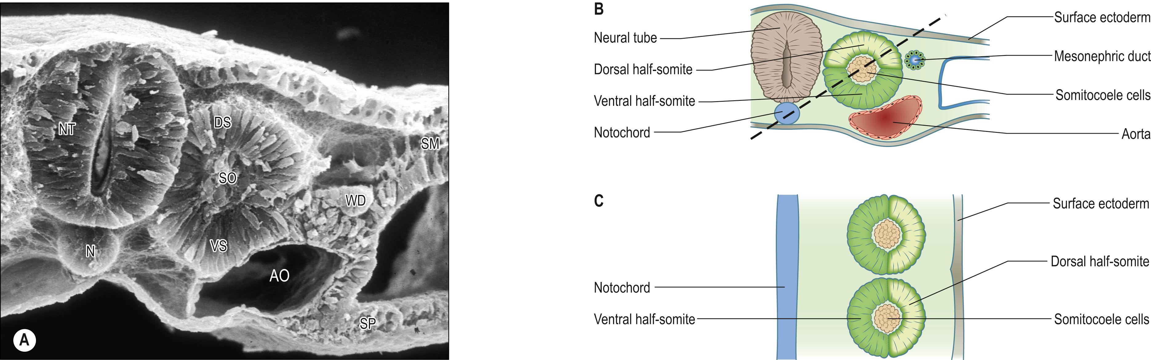 Development of the back - Clinical Tree