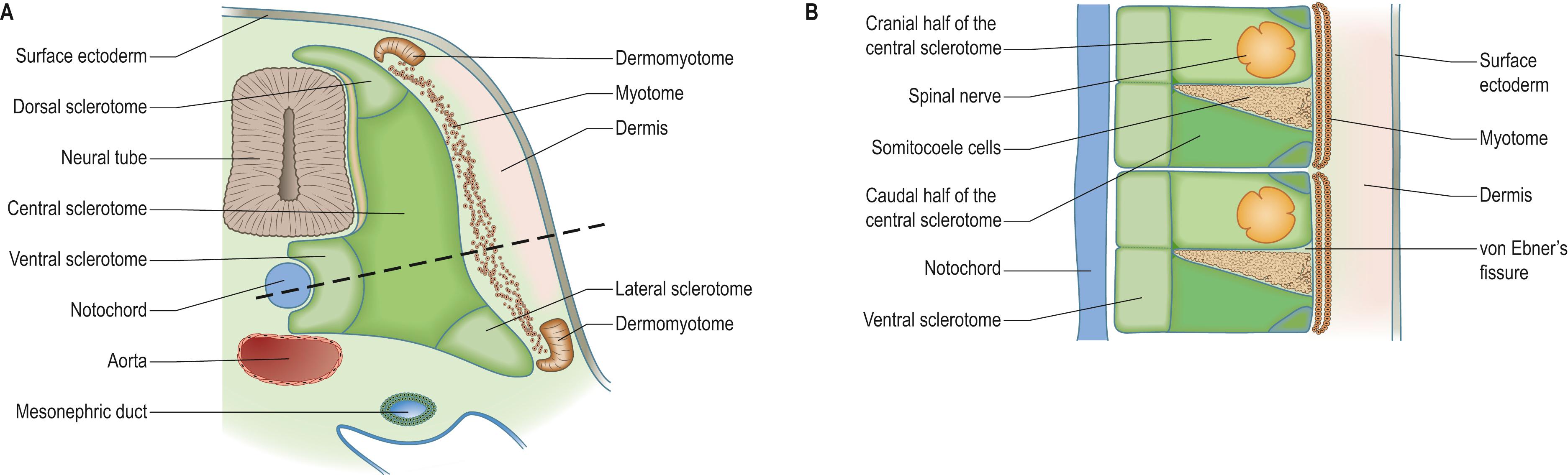 Development of the back - Clinical Tree