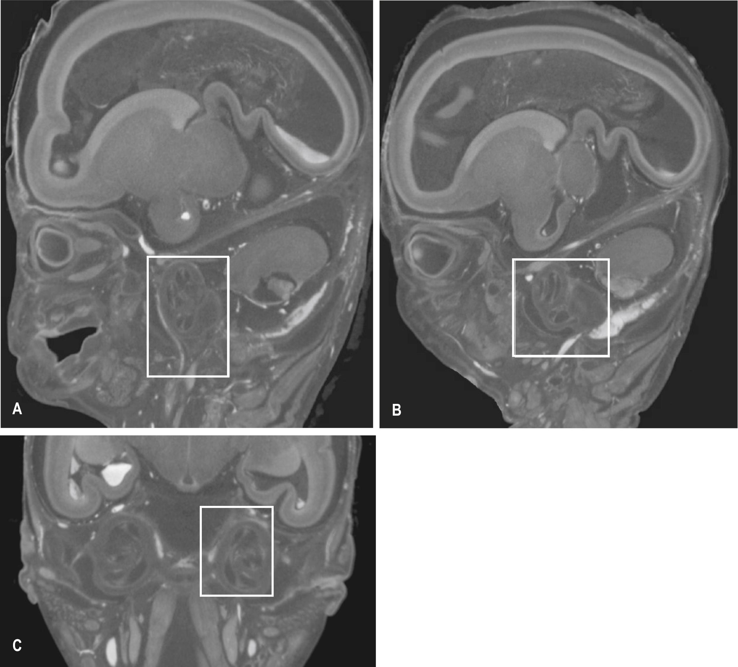 Development of the ear - Clinical Tree