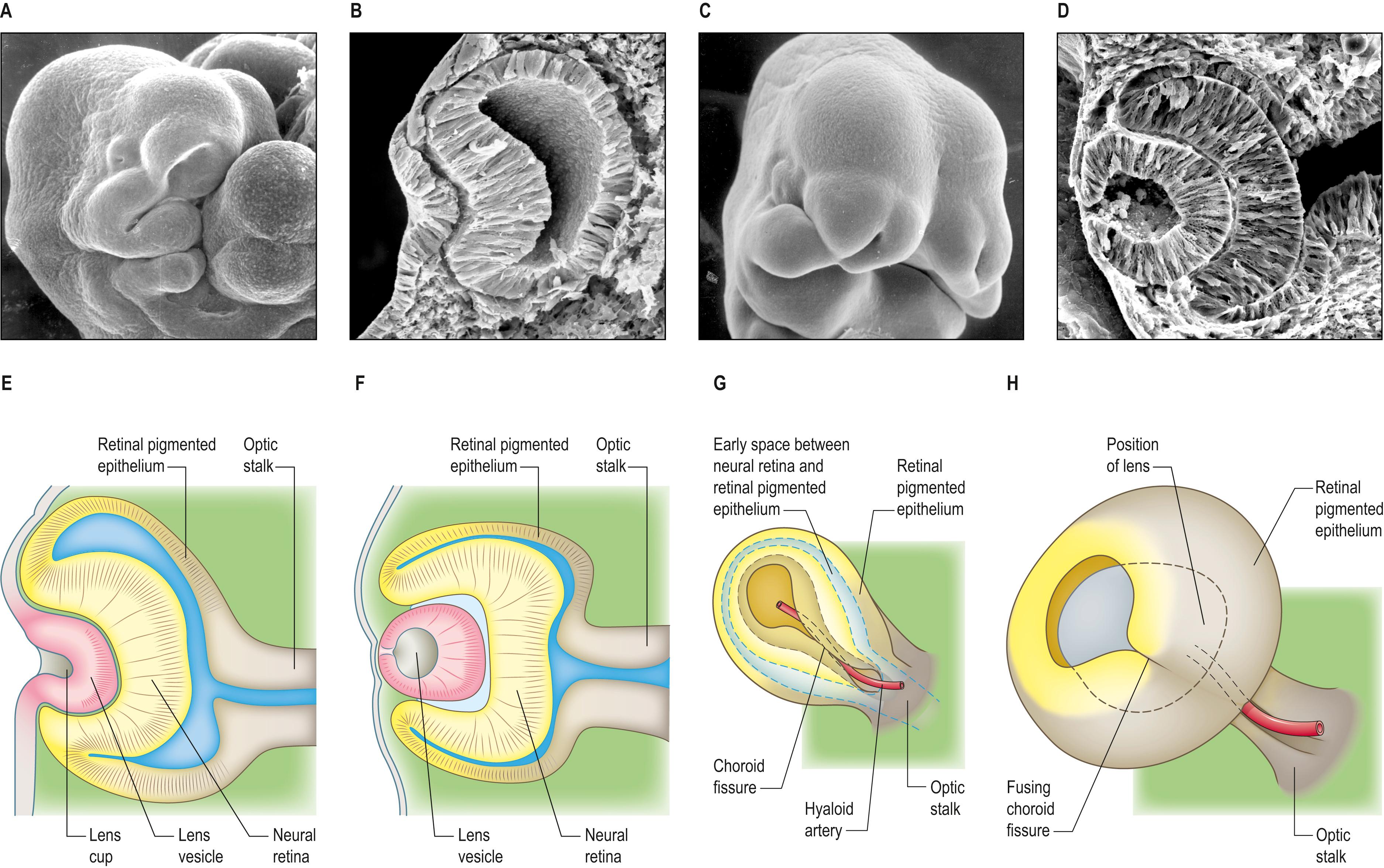 Development of the eye - Clinical Tree