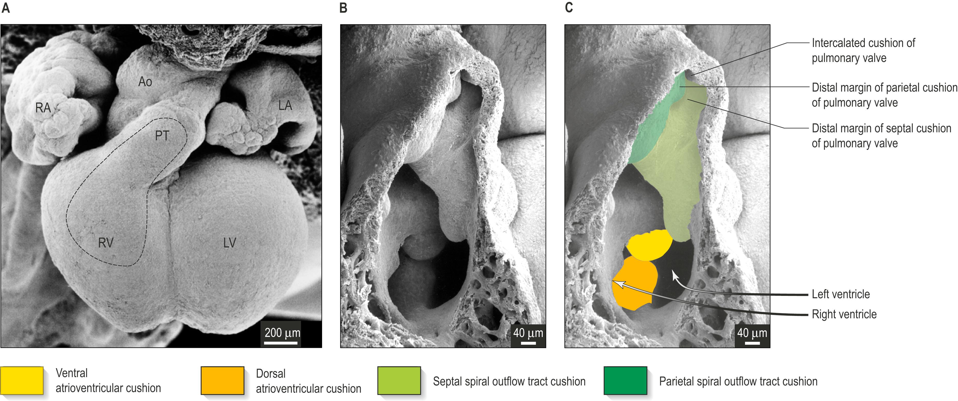Development of the heart and circulation - Clinical Tree