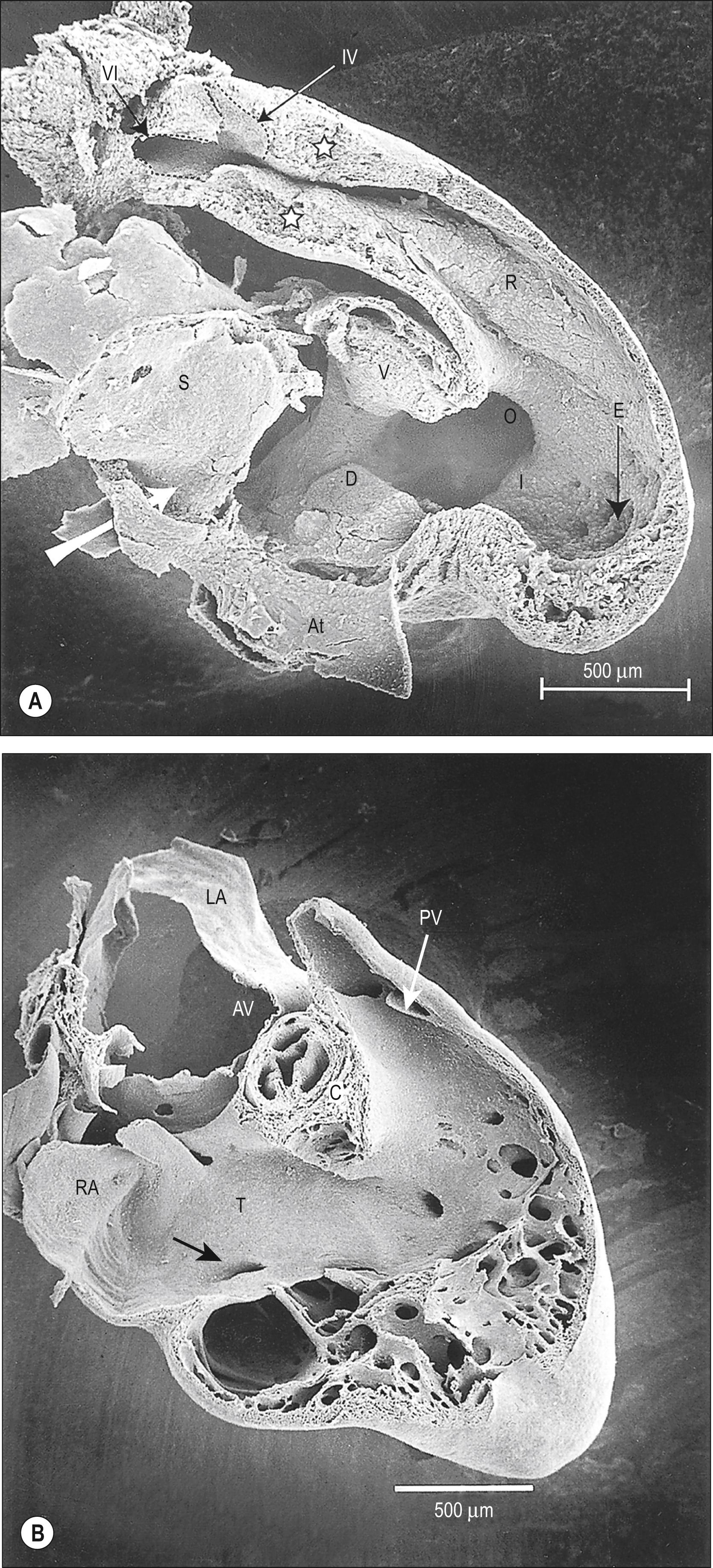 Development of the heart and circulation - Clinical Tree