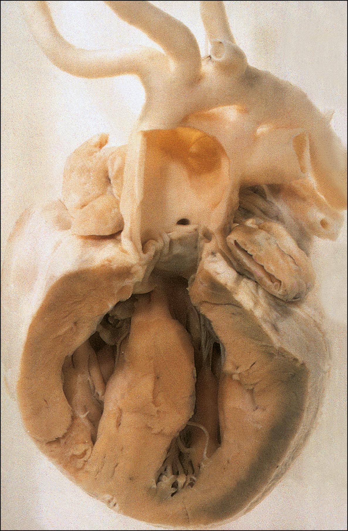 Development of the heart and circulation - Clinical Tree