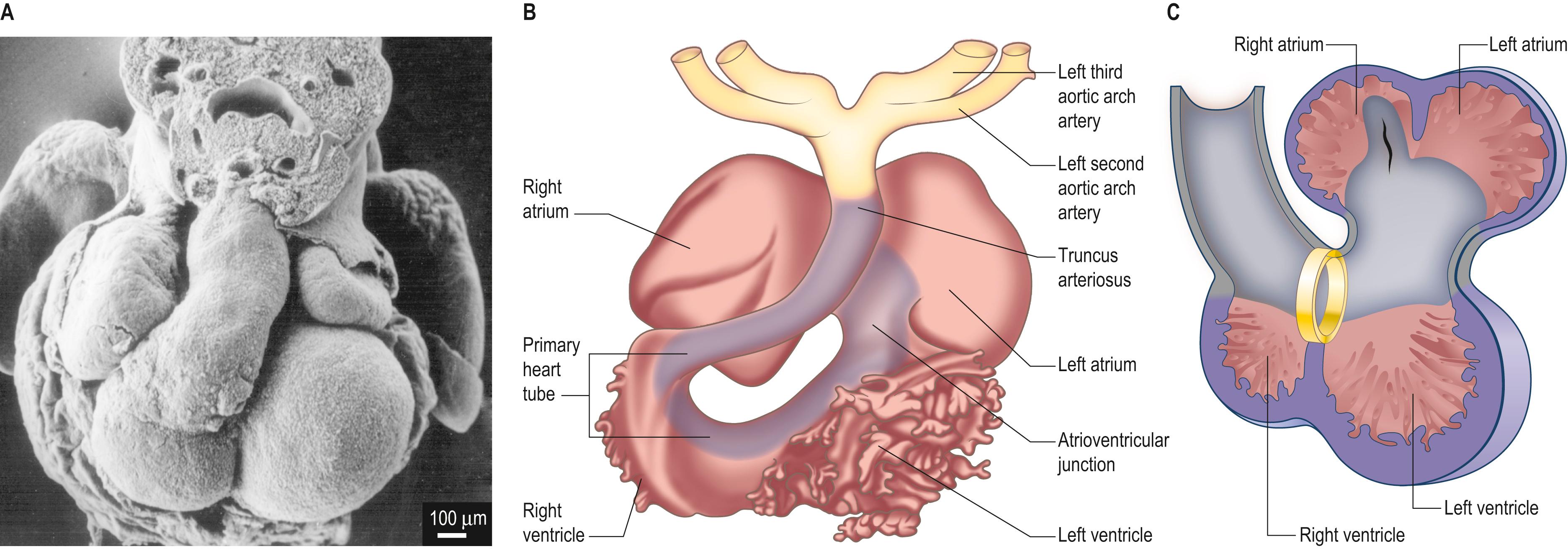 Development of the heart and circulation - Clinical Tree