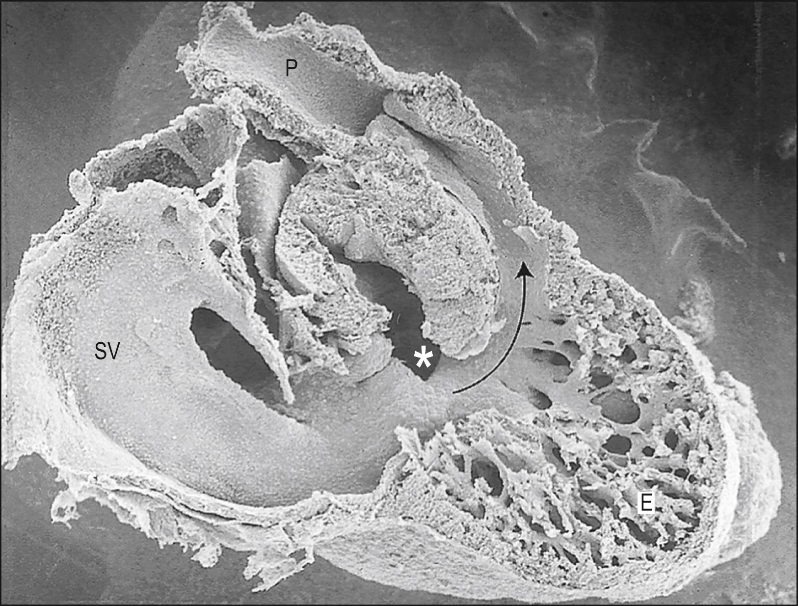 Development of the heart and circulation - Clinical Tree