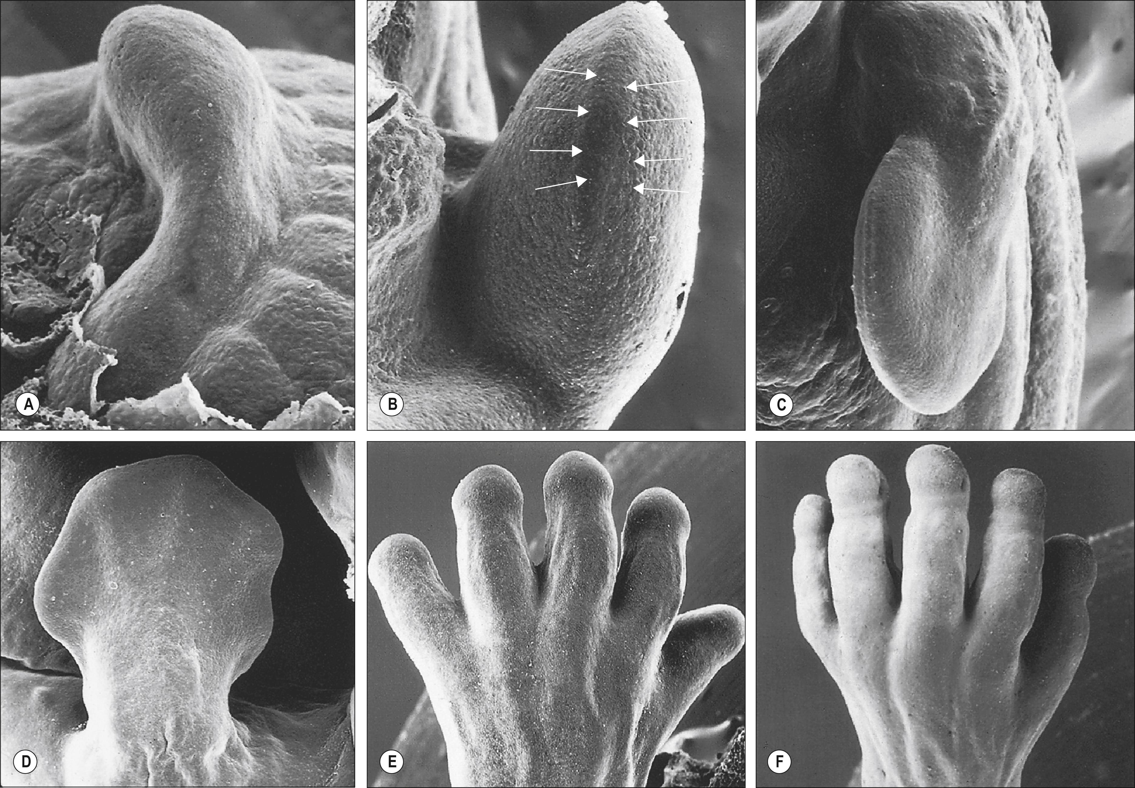 Development of the limbs - Clinical Tree
