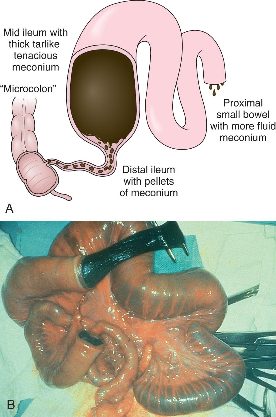 Digestive System Disorders - Clinical Tree
