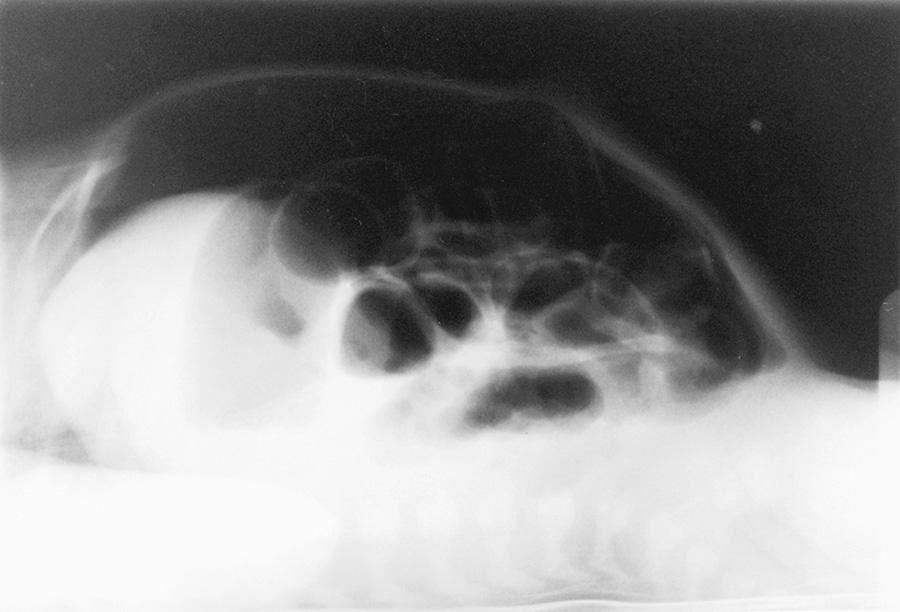 Digestive System Disorders - Clinical Tree