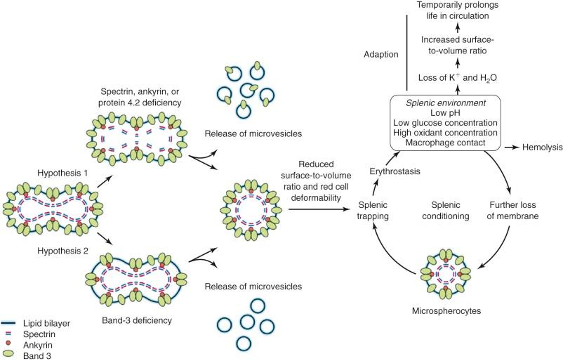 Disorders of the Red Cell Membrane - Clinical Tree