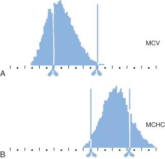 Disorders of the Red Cell Membrane - Clinical Tree