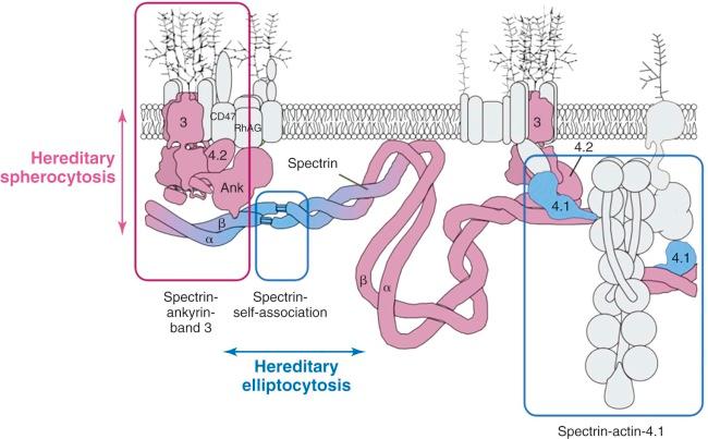 Disorders of the Red Cell Membrane - Clinical Tree