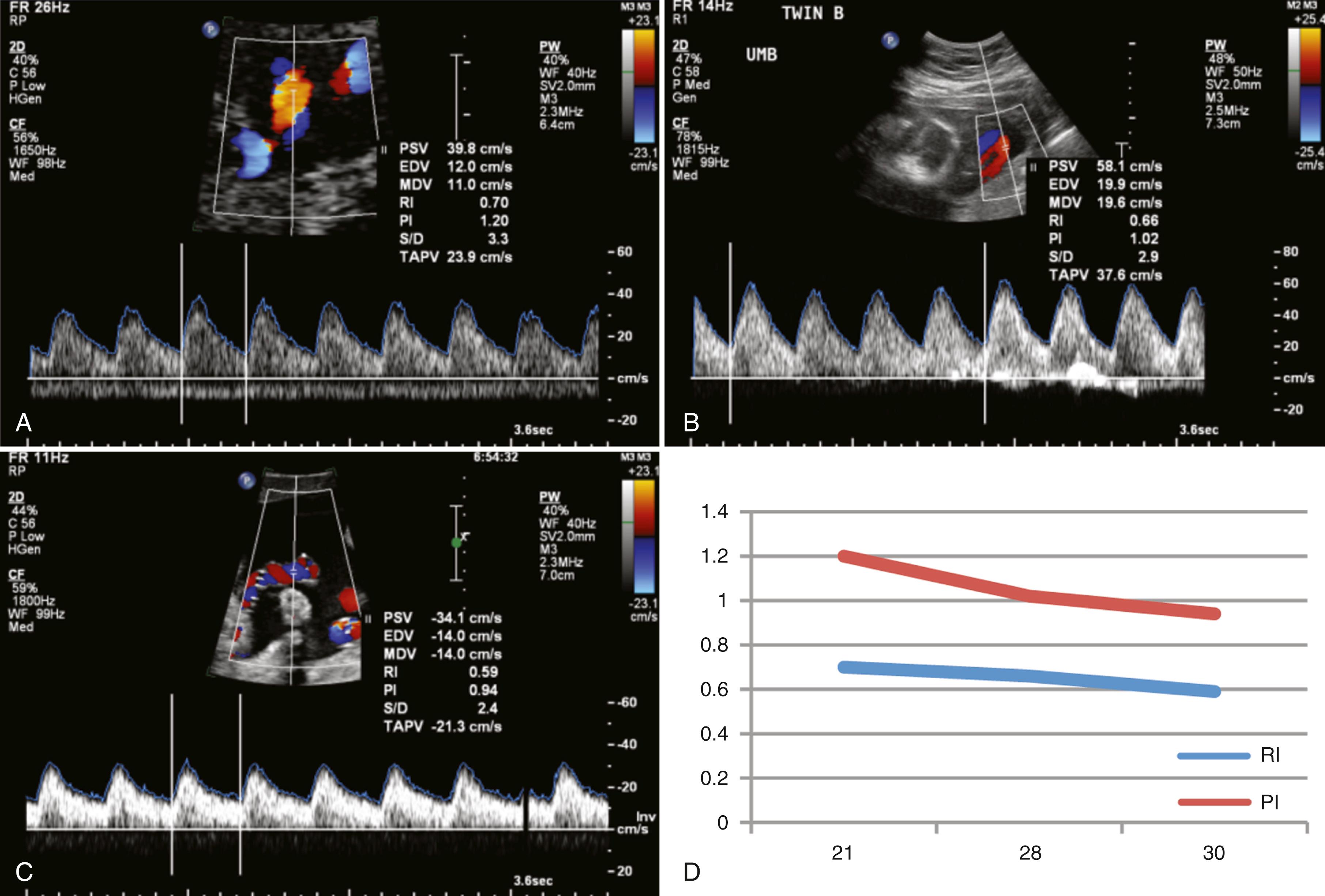 Doppler Ultrasound: Select Fetal and Maternal Applications - Clinical Tree