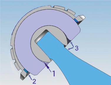 Dual Mobility Implants - Clinical Tree