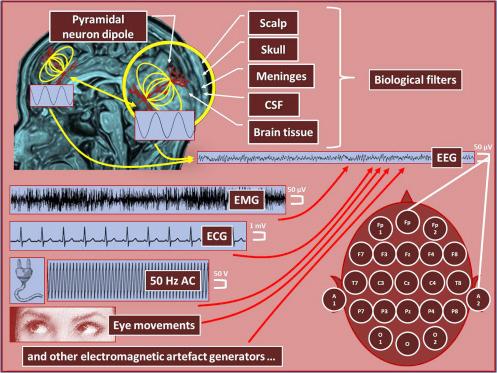 Electroencephalography-Based Monitors - Clinical Tree