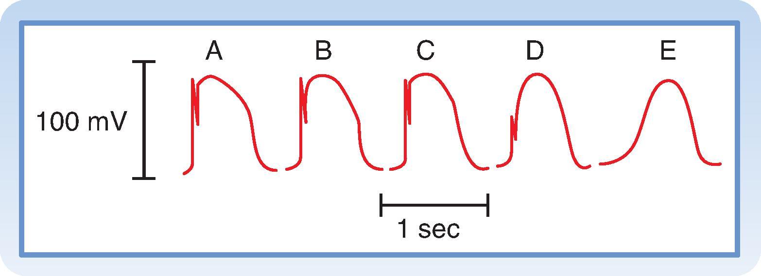 Elements of Cardiac Function - Clinical Tree