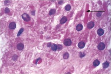 Embryology - Clinical Tree