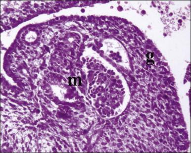 Embryology - Clinical Tree