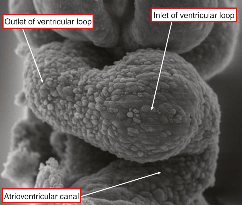 Embryology of the Heart - Clinical Tree
