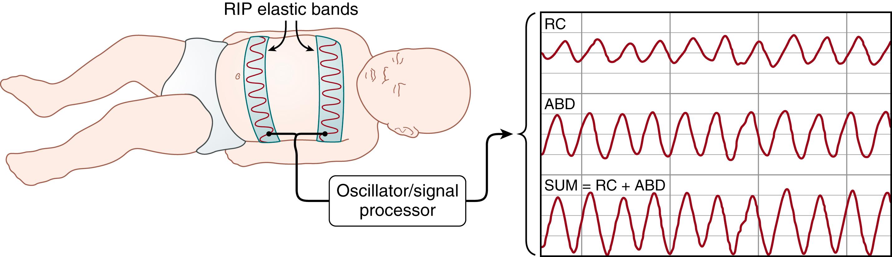 Evaluation of Pulmonary Function in the Neonate - Clinical Tree