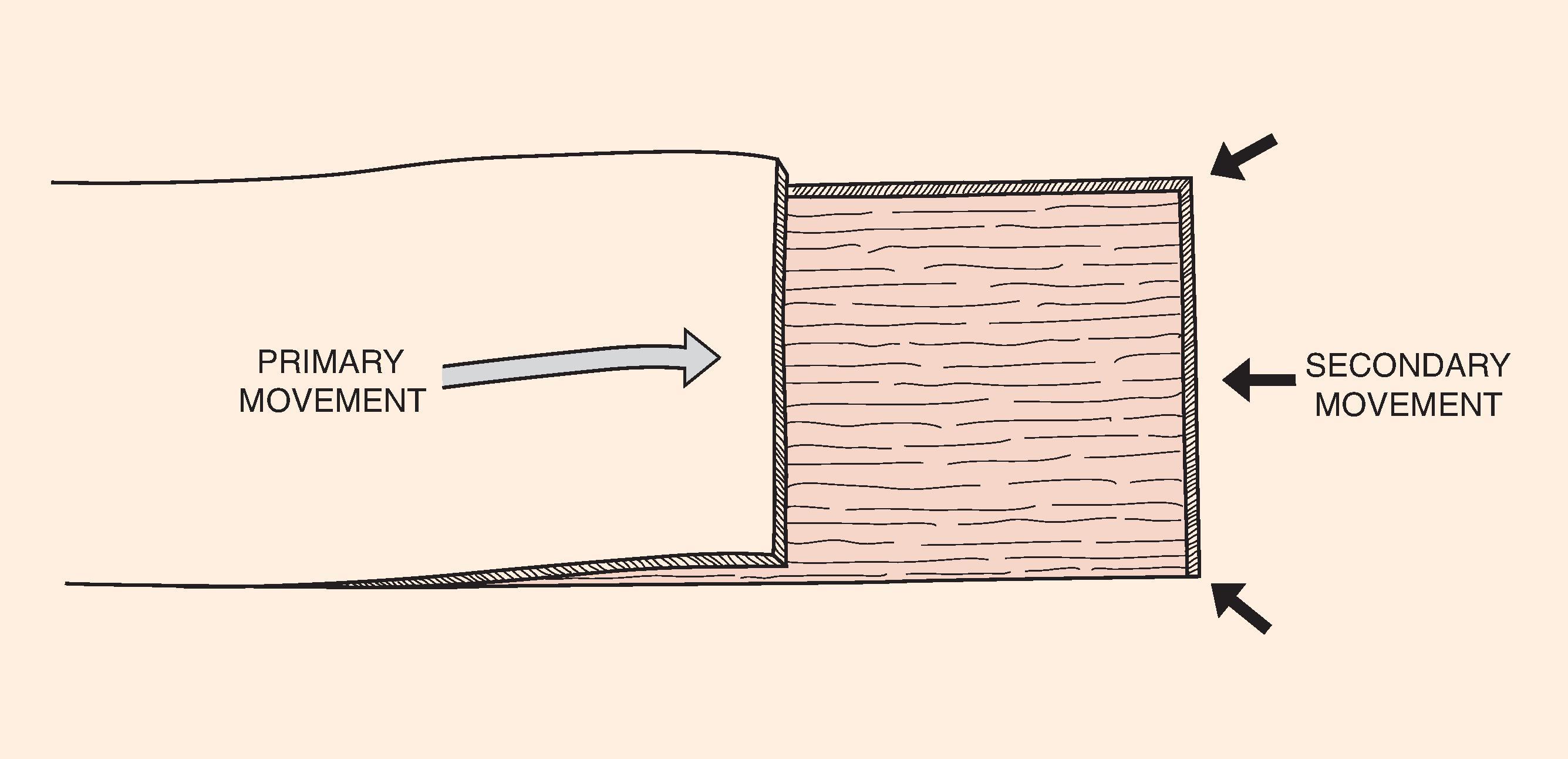 FLAP CLASSIFICATION AND DESIGN - Clinical Tree