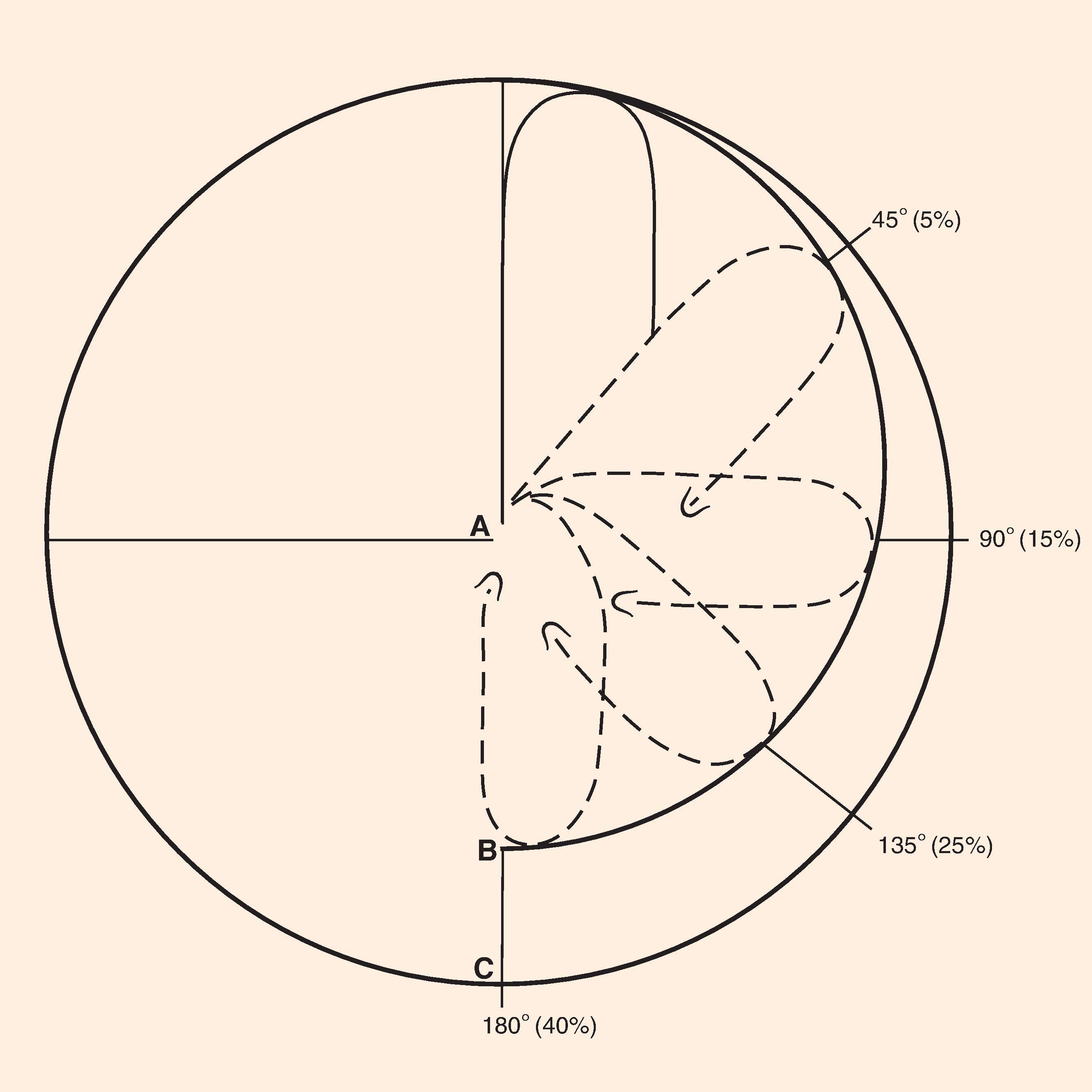 FLAP CLASSIFICATION AND DESIGN - Clinical Tree