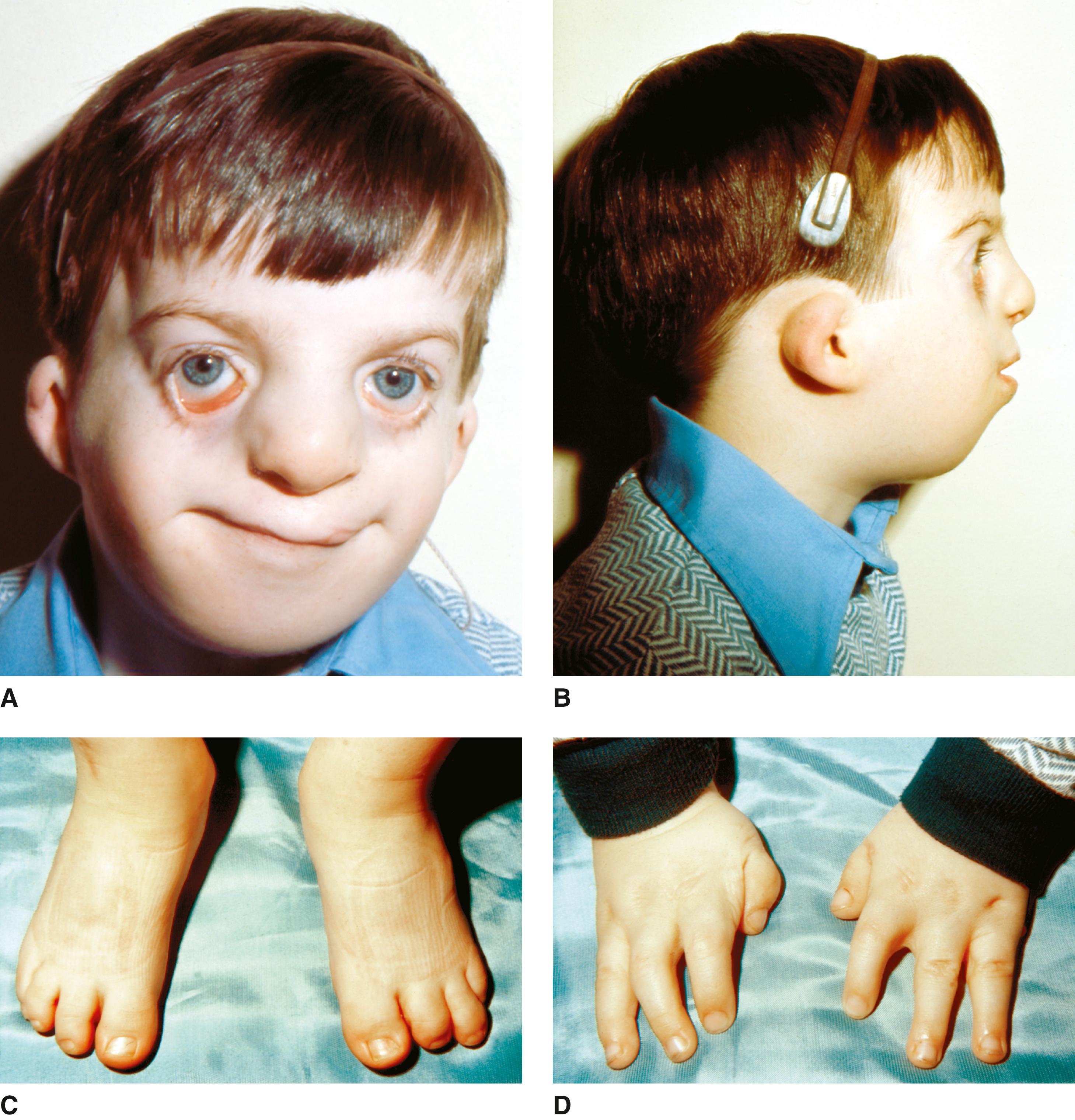 Facial-Limb Defects as Major Feature - Clinical Tree