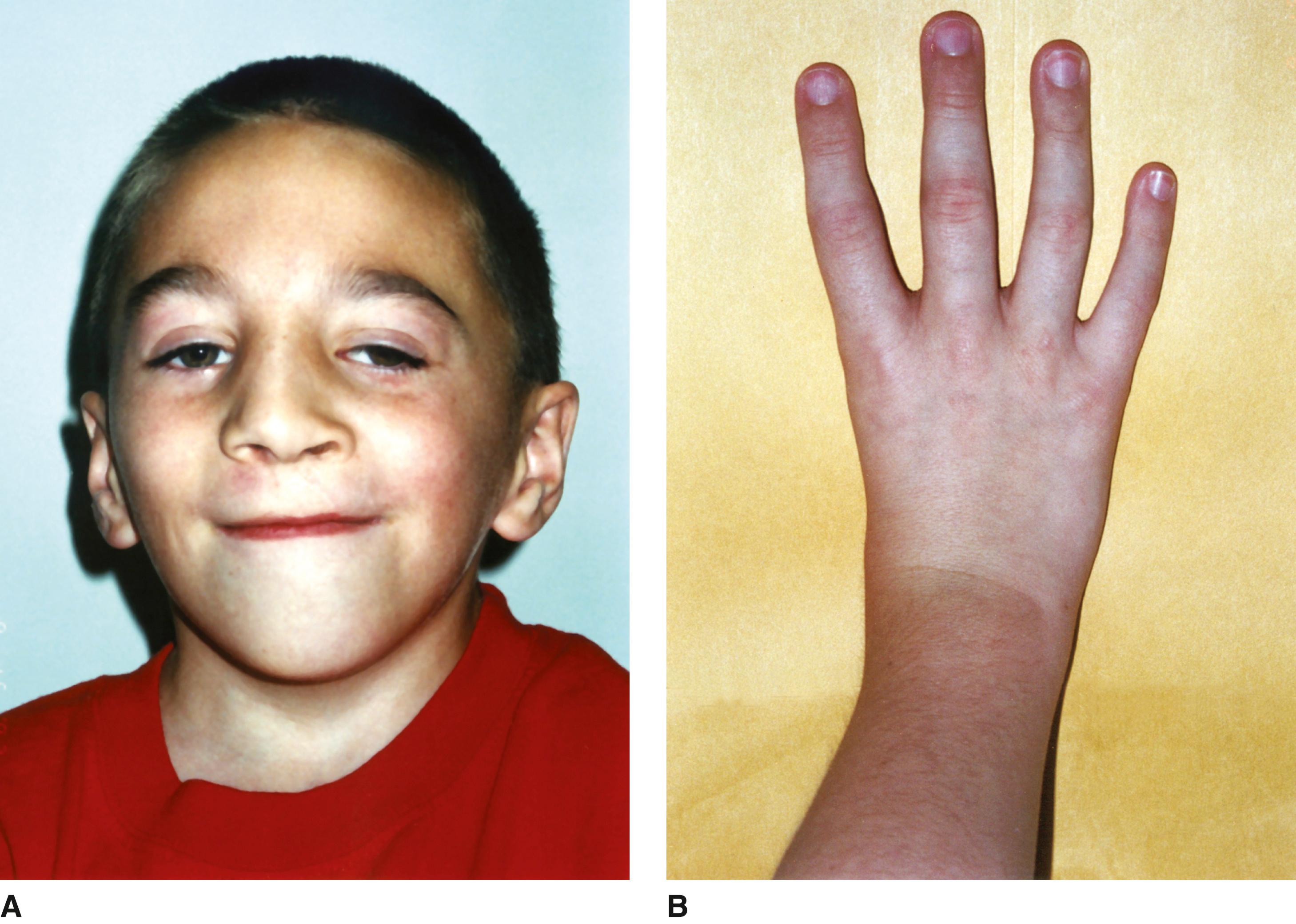 Facial-Limb Defects as Major Feature - Clinical Tree