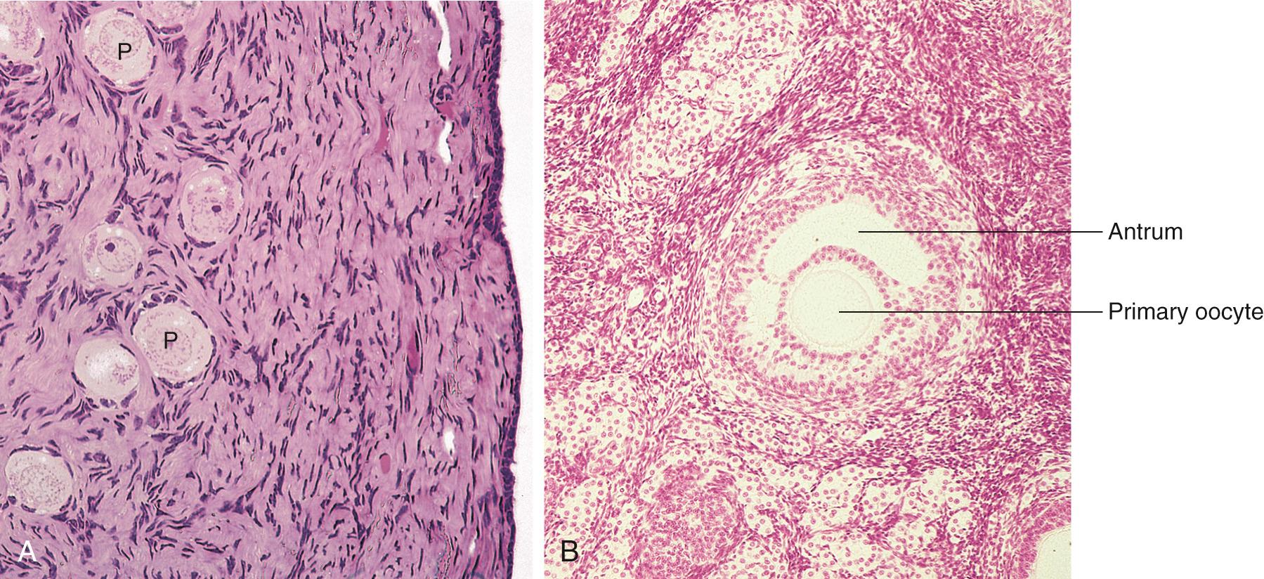 First Week of Human Development - Clinical Tree
