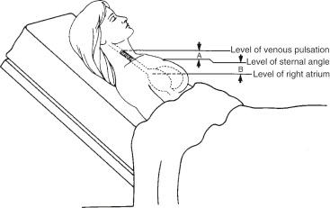 Fluids, Electrolytes, and Acid–Base Status - Clinical Tree