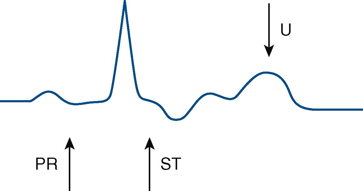 Fluids and electrolyte management - Clinical Tree