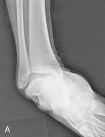 Foot Injuries - Clinical Tree