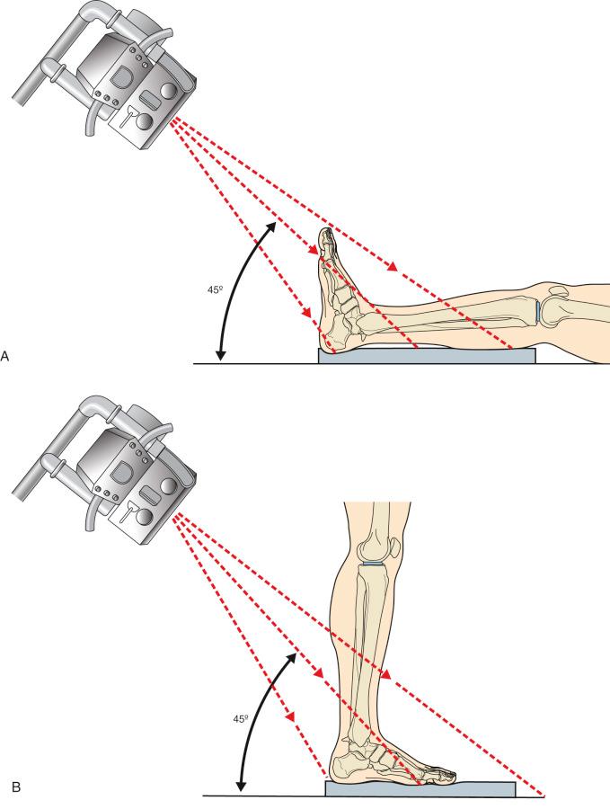 Foot Injuries - Clinical Tree
