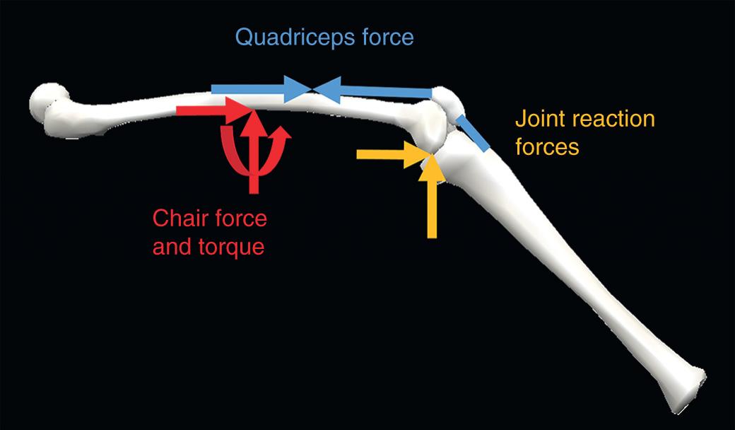 Forward Solution Modeling: An In Vivo Theoretical Simulator of the Knee ...