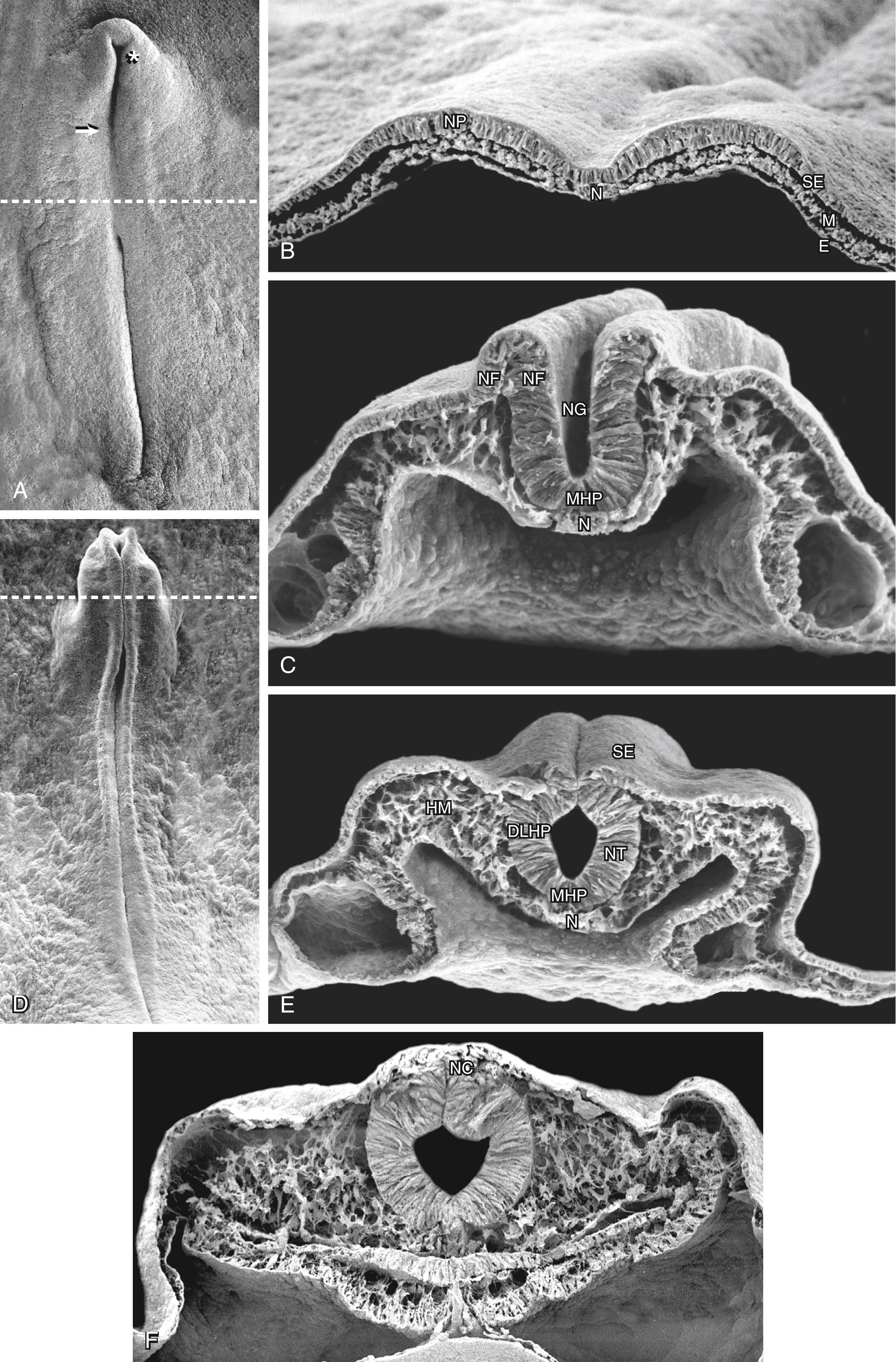 Fourth Week: Forming the Embryo - Clinical Tree