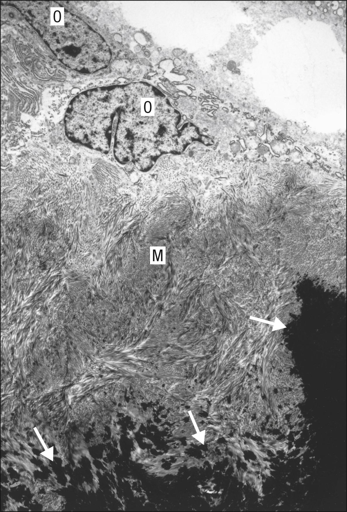 Functional anatomy of the musculoskeletal system - Clinical Tree