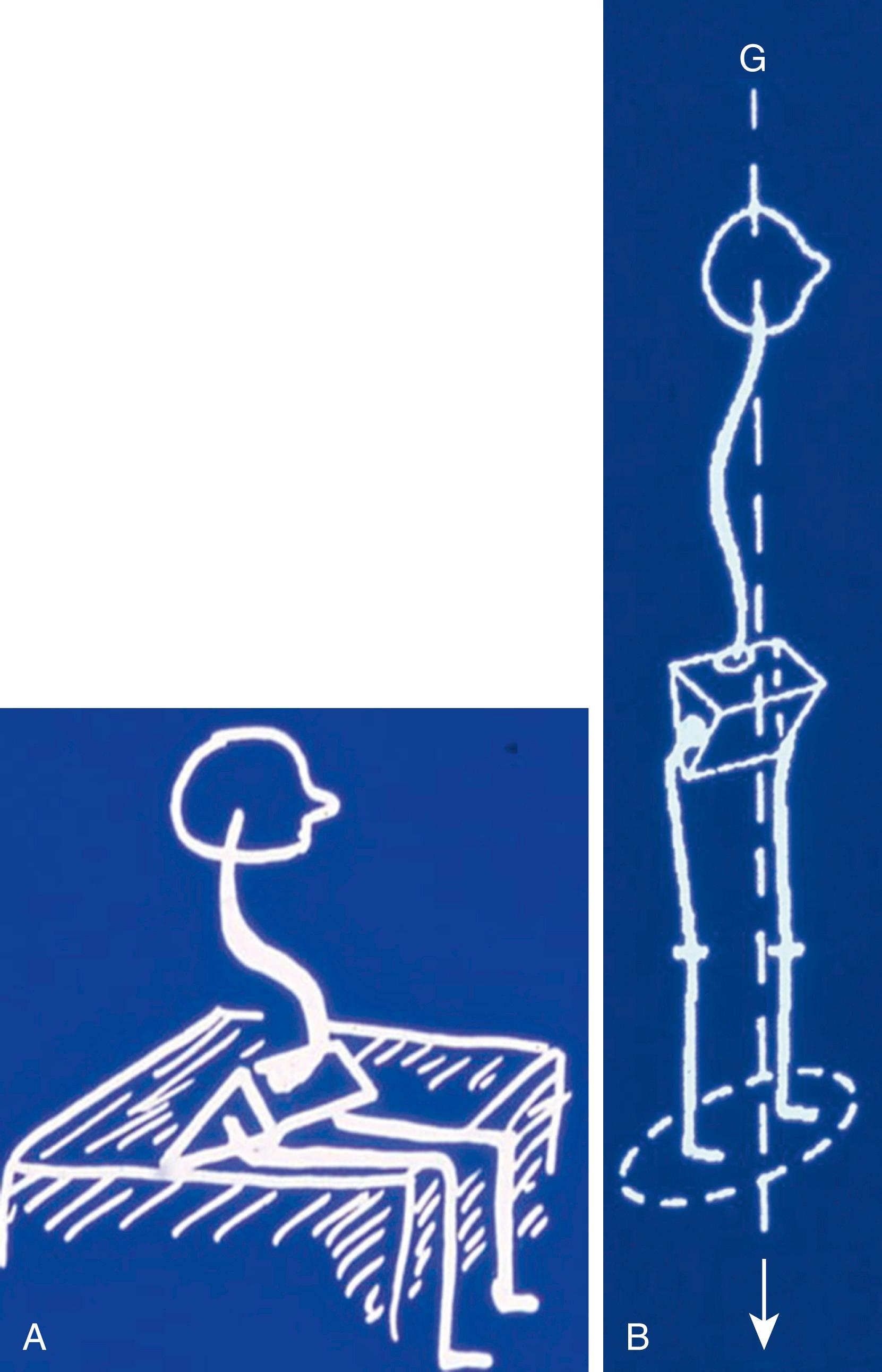 Fundamentals of Spinal Alignment and Balance - Clinical Tree