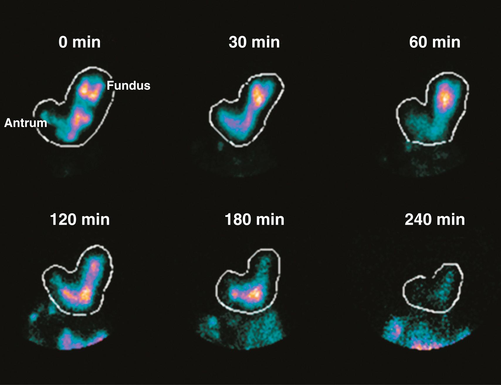 Gastric Neuromuscular Function and Neuromuscular Disorders - Clinical Tree