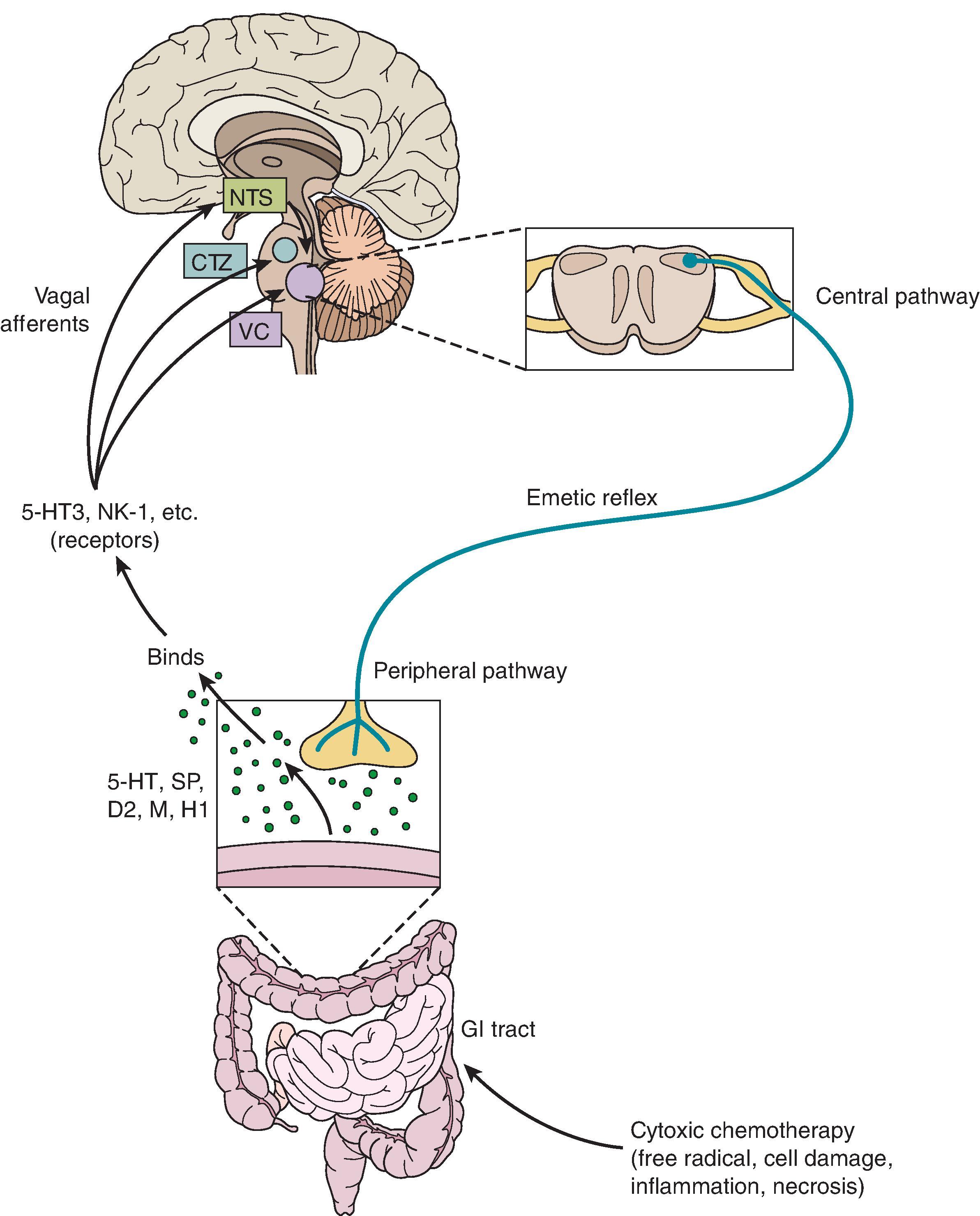 Gastrointestinal Complications of Chemotherapy - Clinical Tree