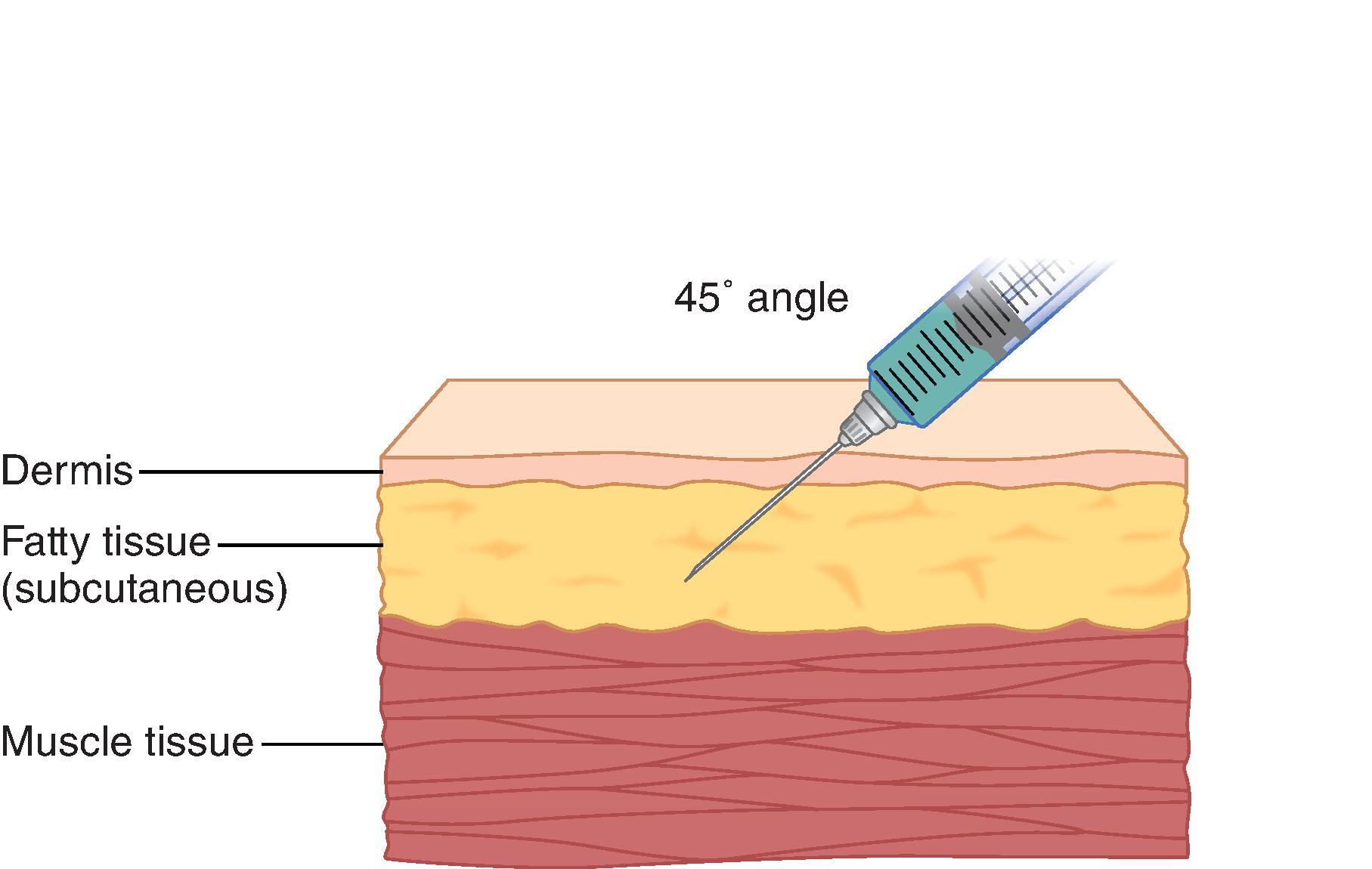 General Immunization Practices - Clinical Tree