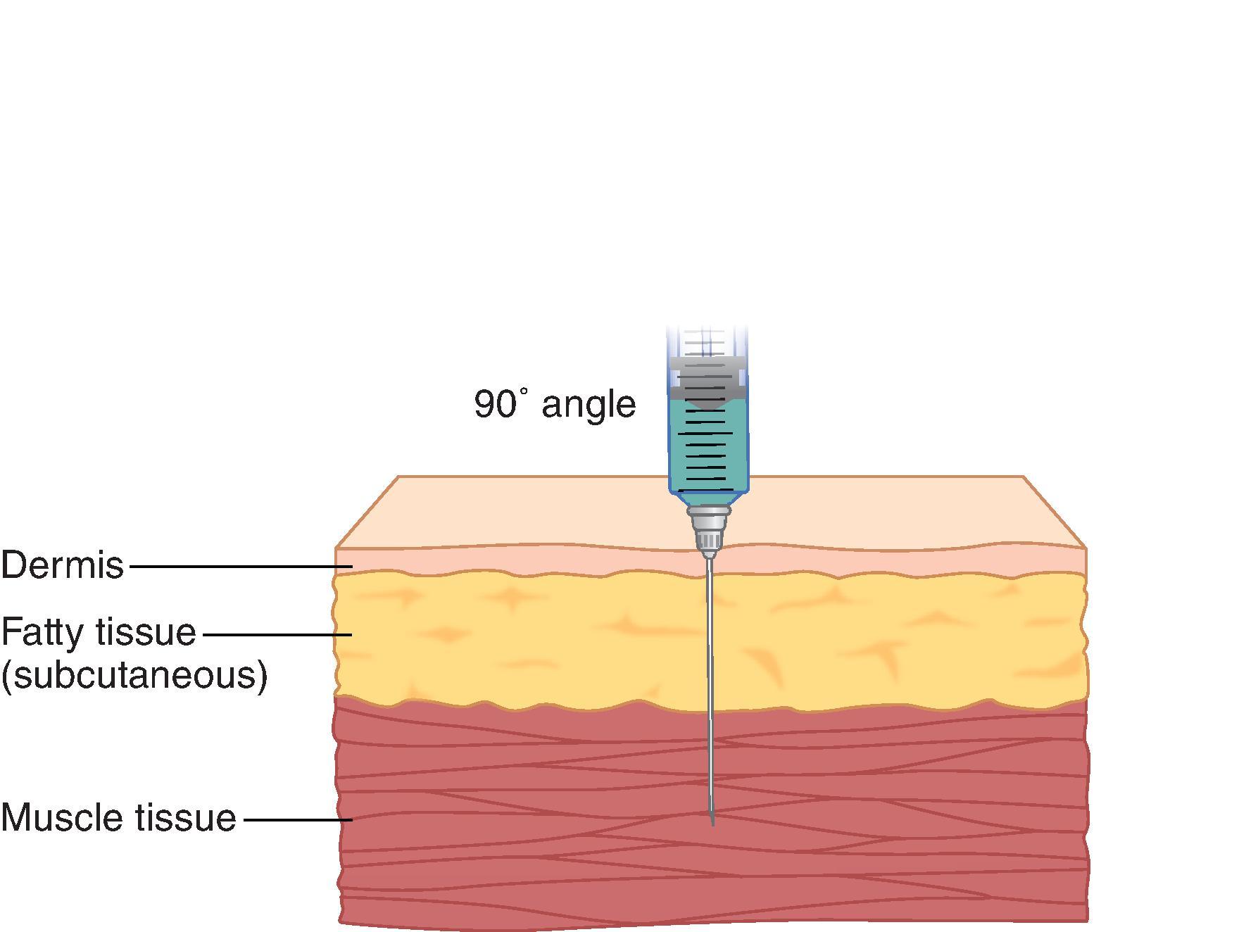 General Immunization Practices - Clinical Tree