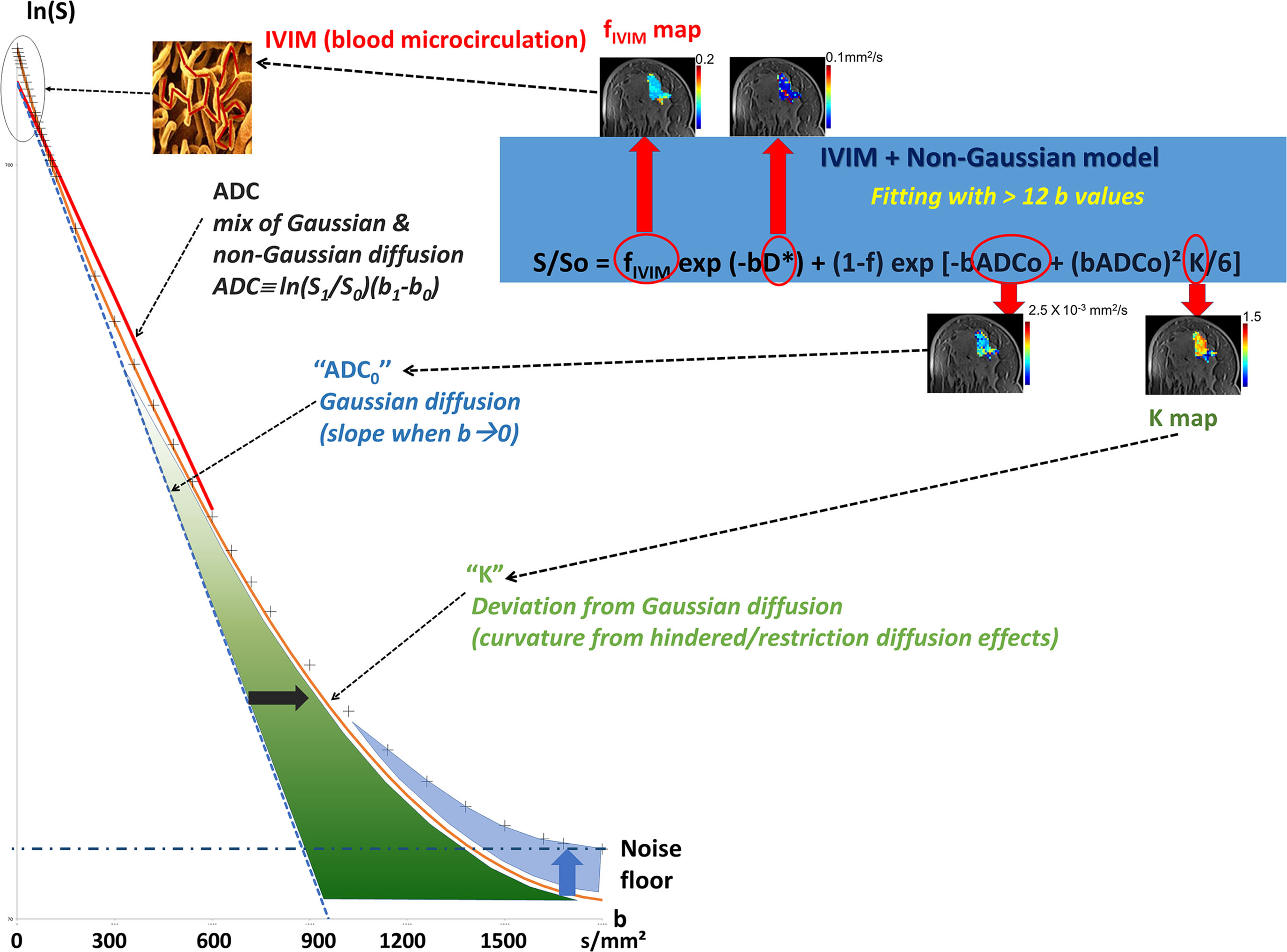 General Principles and Challenges of Diffusion MRI - Clinical Tree