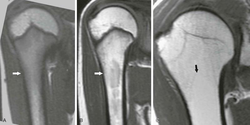 General Principles of MRI of the Bone Marrow - Clinical Tree
