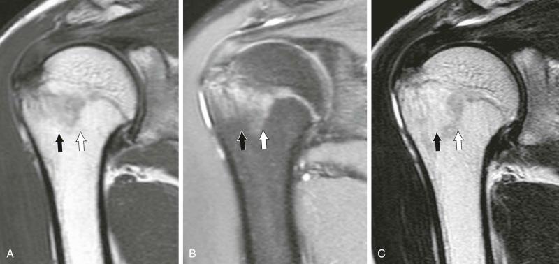 General Principles of MRI of the Bone Marrow - Clinical Tree