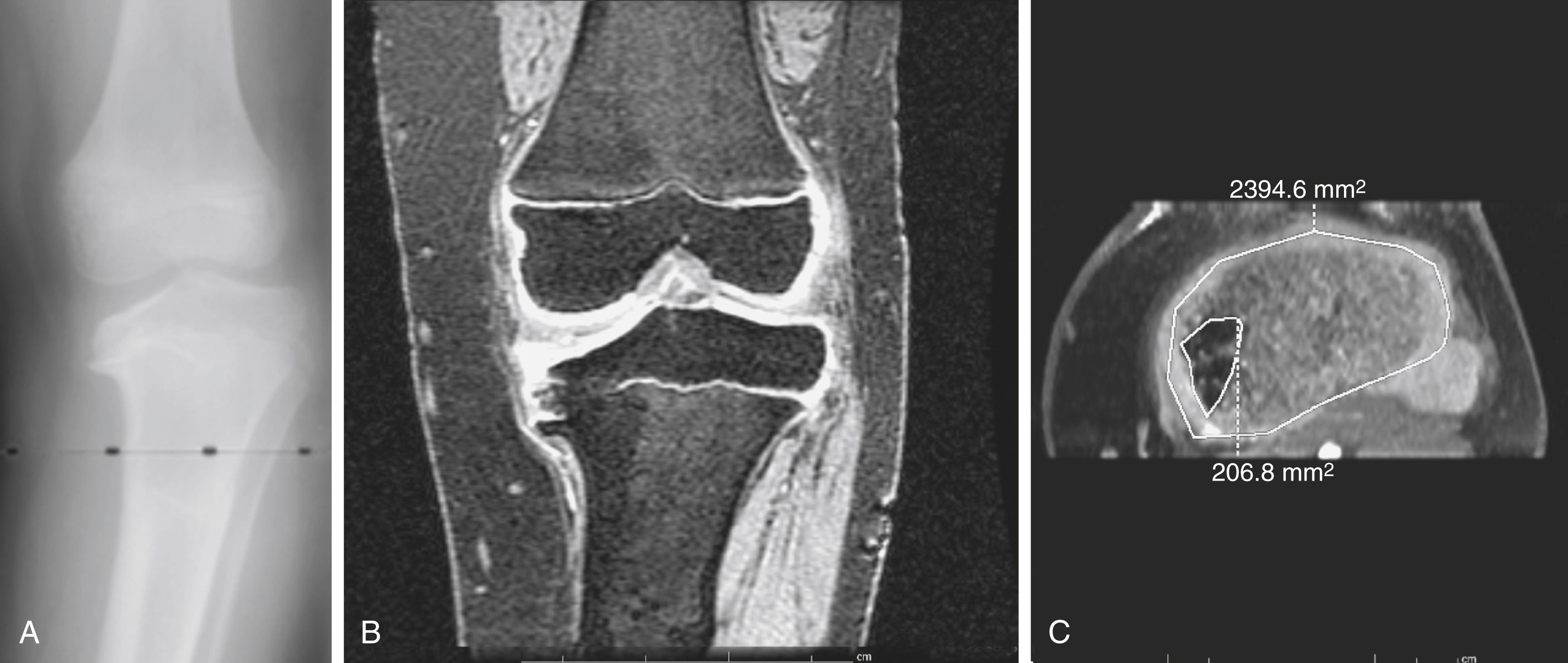 General Principles of Managing Orthopaedic Injuries - Clinical Tree